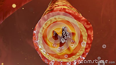 Síntomas De Asma Tratamiento Bronquiol Almacen De Video - Vídeo de ...