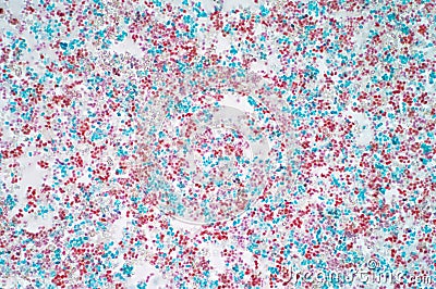 Saccharomyces Cerevisiae Yeast Budding Cell Under Microscope Stock ...