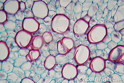 Sambucus Stem With Parenchyma Cells Under The Microscope Royalty-Free ...