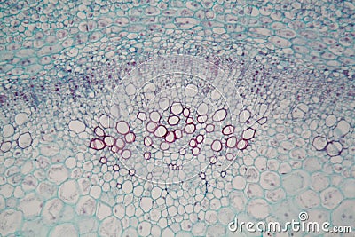 Sambucus Stem With Parenchyma Cells Under The Microscope Royalty-Free ...