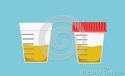 Sample Of Urine Test Vector Illustration. Containers For Analysis ...
