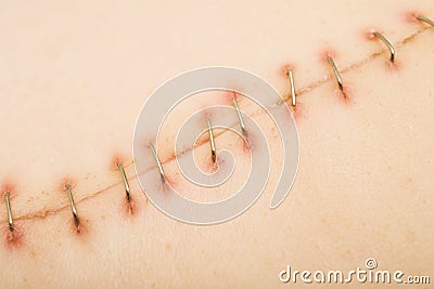 927 Medical Clips Photos - Free & Royalty-Free Stock Photos from Dreamstime