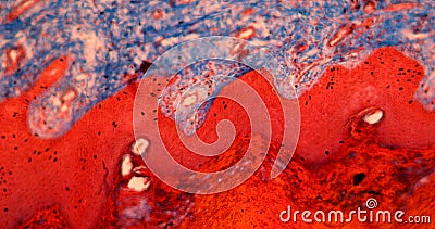 Scar tissue stock footage. Video of skin, cells, digestion - 204808242