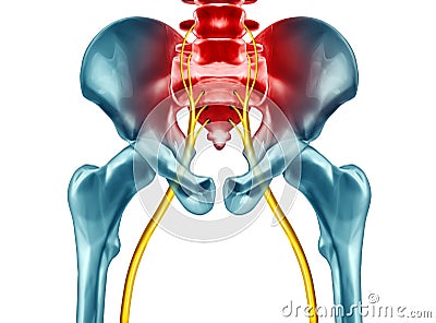 Sciatic Nerve Pain Stock Illustration | CartoonDealer.com #139733605