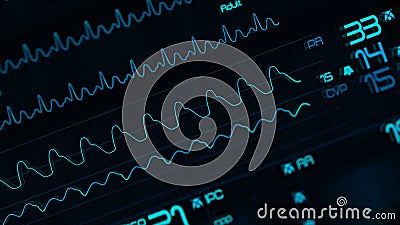 Multi-parameter Patient Monitor Screen / Medical Blue Screen Interface ...