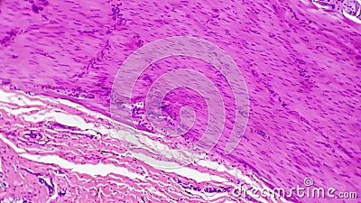 Section of Human Duodenum Filmed Under Microscope with 100x ...