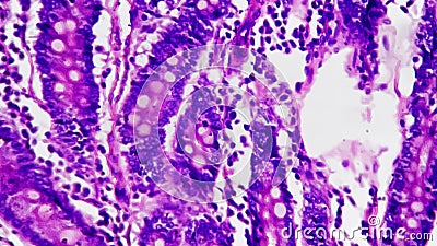 Section of Human Duodenum in High Magnification 400x Filmed Under ...