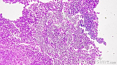 Section of Lymph Node Magnified Under Microscope in 400x Times on ...