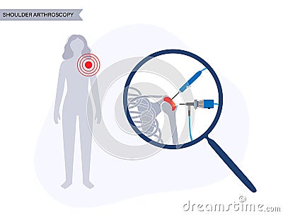 Shoulder Arthroscopy Poster Cartoon Vector | CartoonDealer.com #286186297
