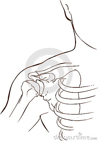 Shoulder Dislocation Stock Illustration | CartoonDealer.com #53691691