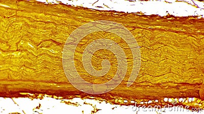 Silvering Pattern of Human Nerves Trunk in Longitudinal Section Under ...
