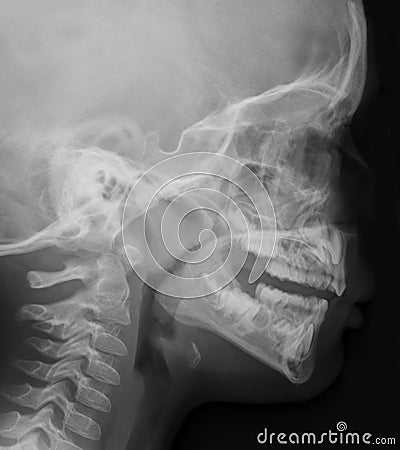 Xray/Face side stock image. Image of health, disease, diagnosis - 198831