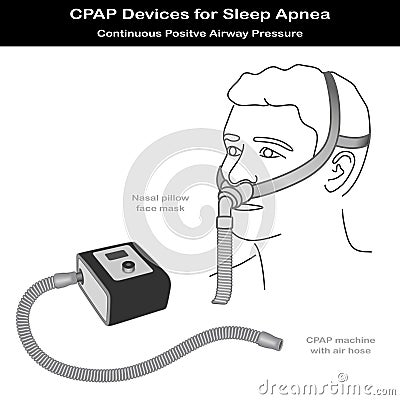 Sleep Apnea, CPAP Machine, Nasal Pillow Mask Cartoon Vector ...
