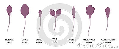 Spermogram And Semen Parameters, Teratozoospermia, Normal And Abnormal ...