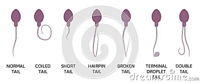 Spermogram And Semen Parameters, Teratozoospermia, Normal And Abnormal ...