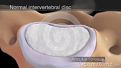Spinal Cord , Normal Intervertebral Disc 3D Animation Stock Footage ...