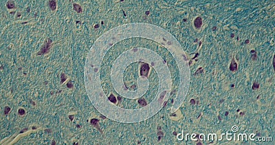 Spinal nerves cells stock footage. Video of system, science - 205765788