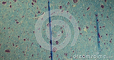 Spinal Nerves of the Rat in Cross Section Stock Footage - Video of ...