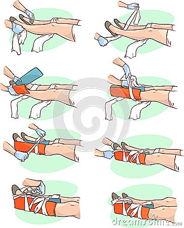 Splinting A Broken Leg Vector Illustration | CartoonDealer.com #61344834