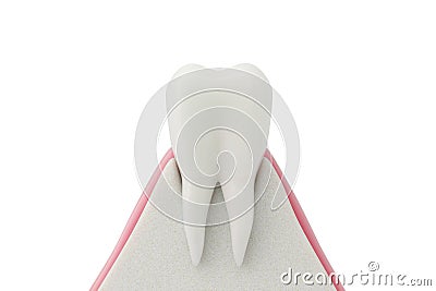 Healthy Gums And Periodontitis Disease Comparison. Dental Health ...