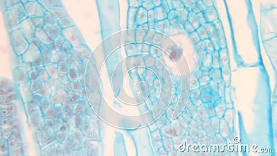 A stained slide of moss stock footage. Video of plant - 237521378