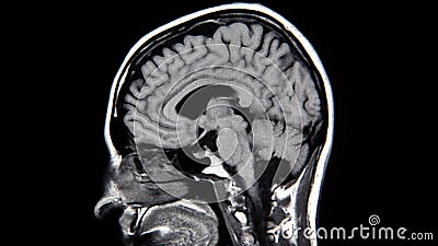 Stop Motion Animation of a Human Brain Stock Footage - Video of ...