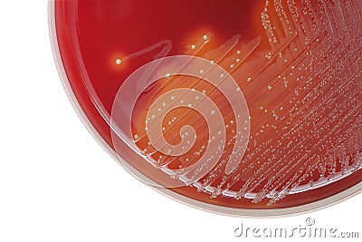 Streptococcus Bacterial Colonies With Beta Hemolytic On Blood Ag Stock ...