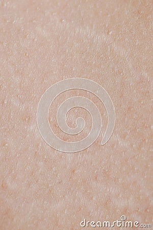 Stretch On Human Skin Background Stock Image | CartoonDealer.com #223616617