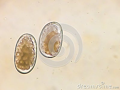 Strongyle Eggs Under The Microscope, Uncinaria/Ancylostoma, Hookworm ...