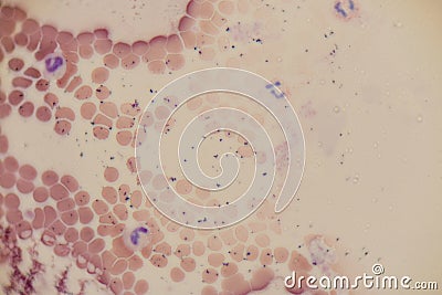 Study Of White Blood Cells Are The Cells Of The Immune System Under The ...