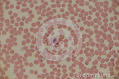 Study Of White Blood Cells Are The Cells Of The Immune System Under The ...