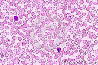 White Blood Cells Are The Cells Of The Immune System Under The ...