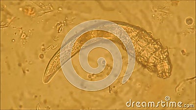 Subcutaneous Mite Demodex Canis Stock Footage - Video of dermis ...