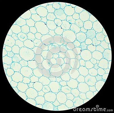 Sunflower Stalk Cross-section Under The Microscope, (Helianthus Royalty ...