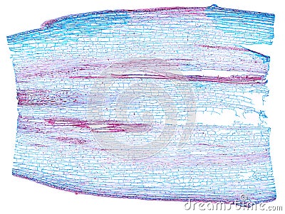 Sunflower Stem, Helianthus Annuus, Longitudinal Section, 20X Micrograph ...