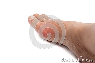 Swollen Foot With Gout Inflammation Stock Photo - Image: 45651982