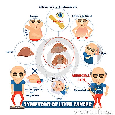 Symptome Von Leberkrebs Vektor Abbildung - Bild: 64375304