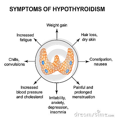 Hyperthyroidism Symptoms Stock Illustrations – 66 Hyperthyroidism ...