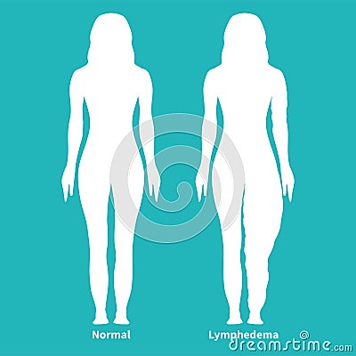 Teal Lymphedema Silhouette Illustration With Woman With Normal And ...