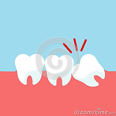 Teeth And Gum Problems. Impacted Wisdom Tooth For Dentistry And Dental ...