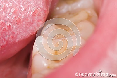 Human tongue texture stock photo. Image of papilla, closeup - 28622740