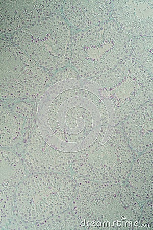 Testicle Cross-section Under The Microscope Stock Photography ...