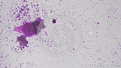 Three Types of Bacteria are Filmed Under Microscope Against Bright ...