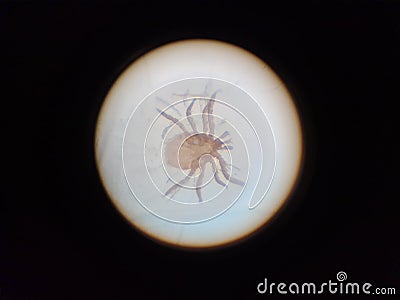Tick Under Microscope Royalty-Free Stock Image | CartoonDealer.com ...