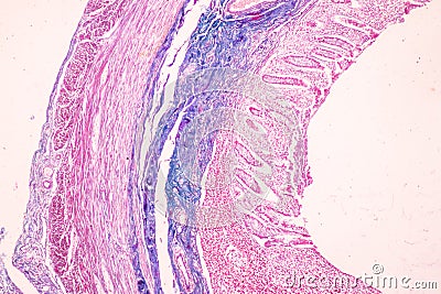Small Intestine Duodenum And Vermiform Appendix Human Under The ...
