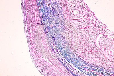 Small Intestine Duodenum And Vermiform Appendix Human Under The ...