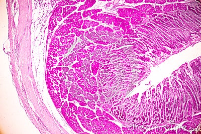 Small Intestine Duodenum And Vermiform Appendix Human Under The ...
