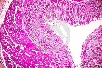 Small Intestine Duodenum And Vermiform Appendix Human Under The ...
