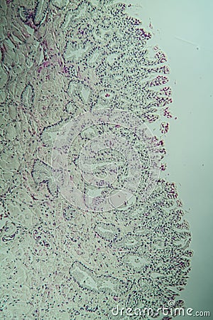 Toad Cross Section Through The Tongue Stock Image | CartoonDealer.com ...