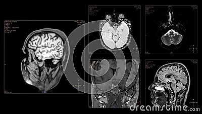 Head MRI Scan From Different Angles Stock Photography | CartoonDealer ...
